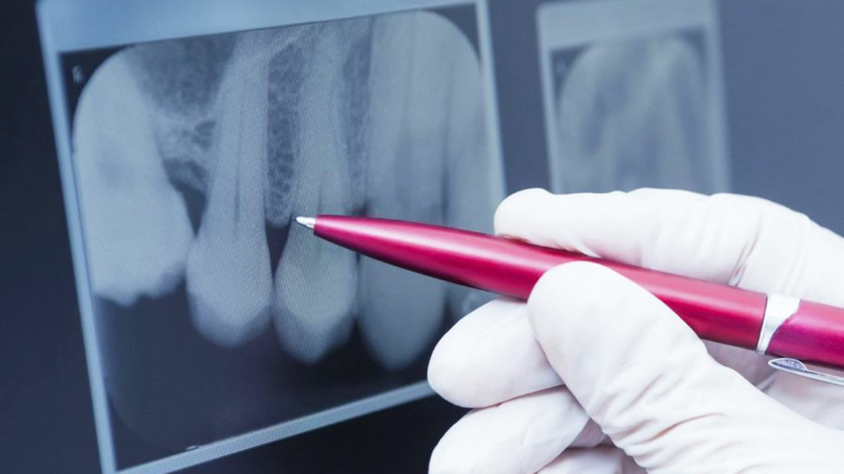 Dhëmbët dhe Zemra – Cila është Lidhja Mes të Dyjave – Arena e Lajmit