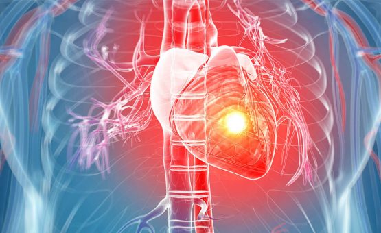 sëmundjet kardiovaskulare - AgroWeb