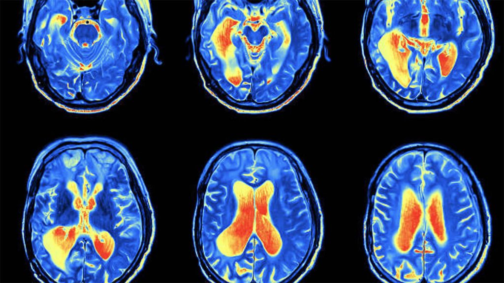 Trupi & Shëndeti - AgroWeb