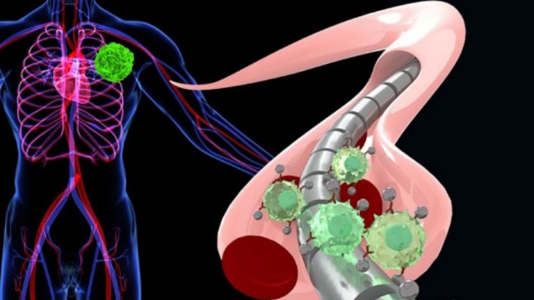 qelizat tumoriale - AgroWeb