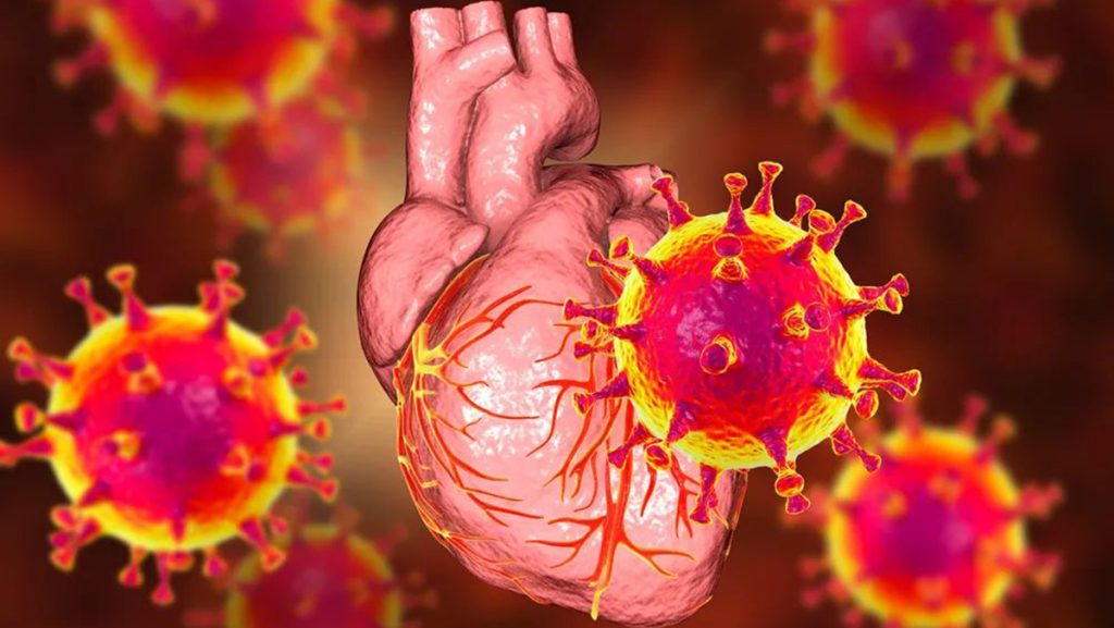 Miokardi Dhe Vaksinat - Çfarë Këshillojnë Mjekët Për Inflamacionin e ...